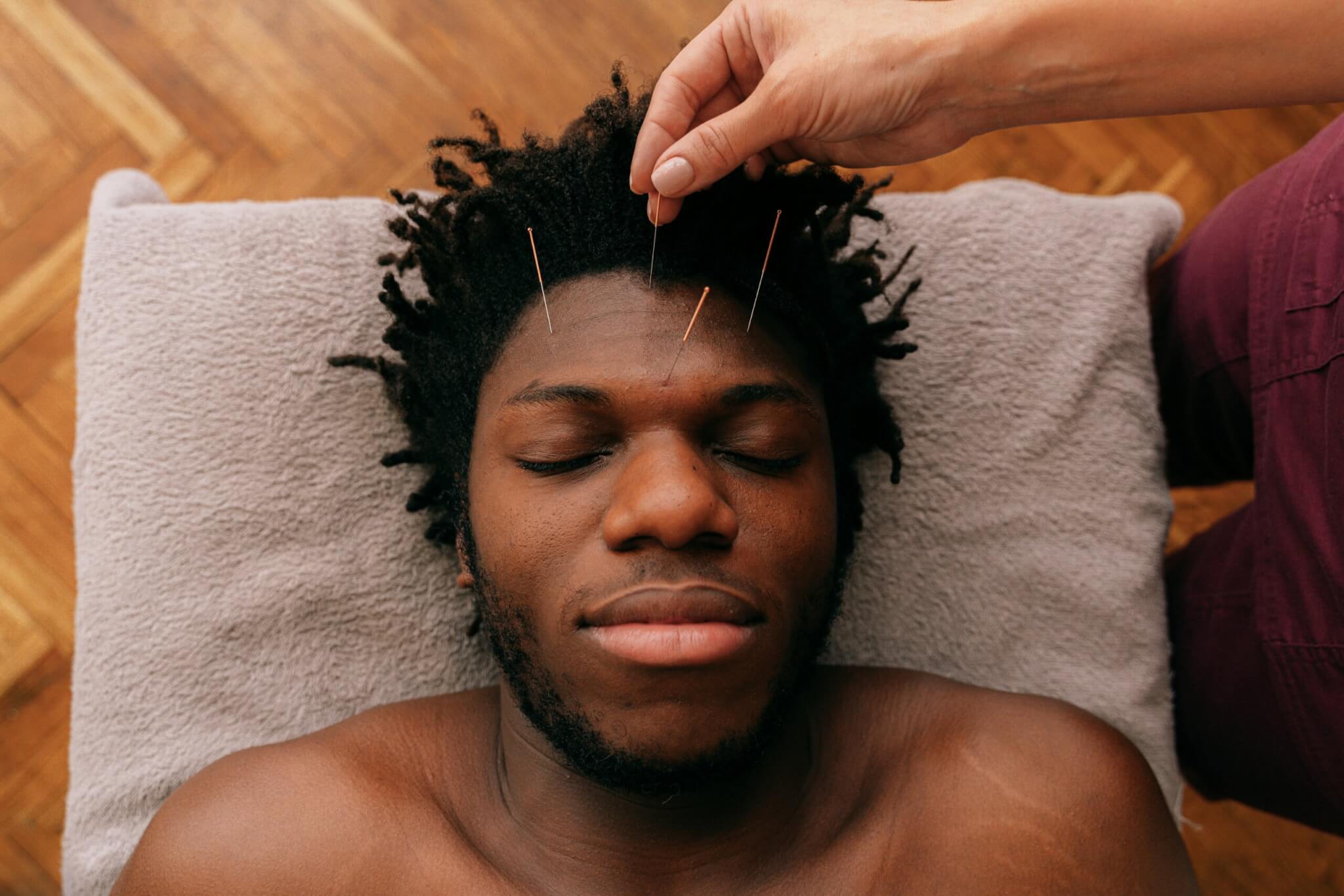 Acupuncture Could Help Prevent Diabetes Research Shows